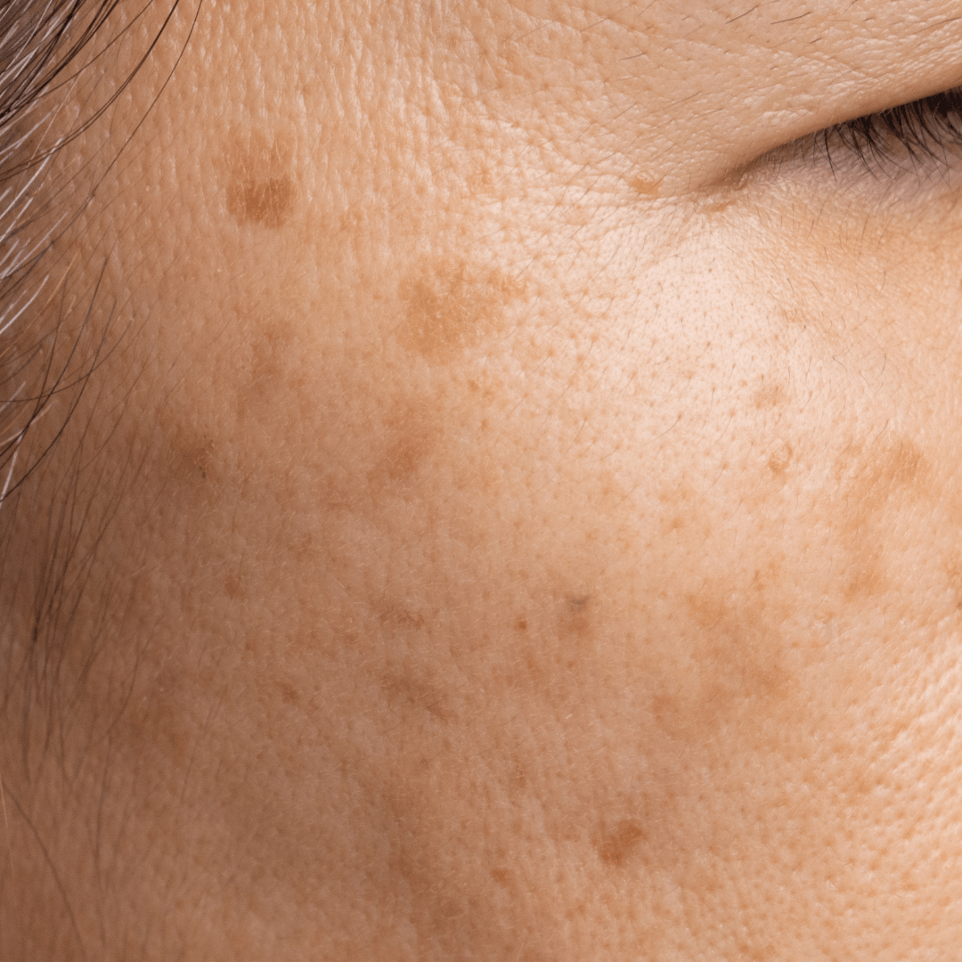 HOME CARE | krxaesthetics.com